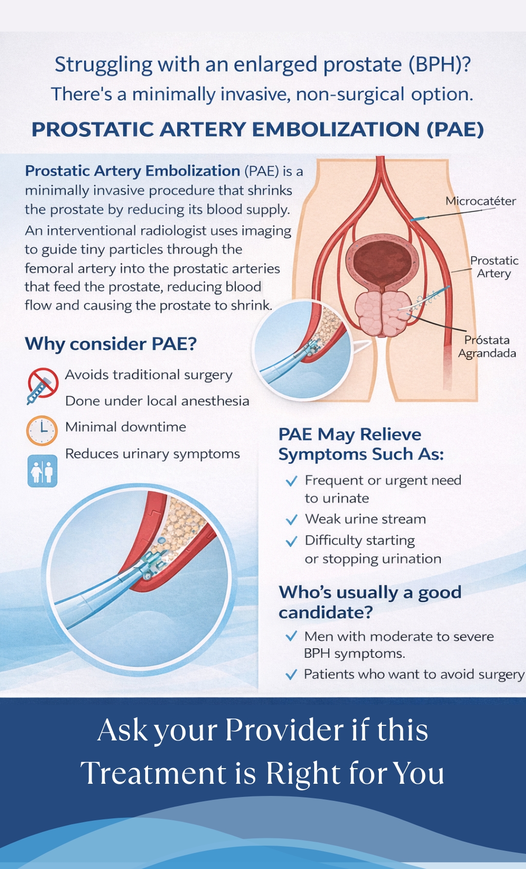 Prostate Artery Embolization (PAE) in Tustin, CA | Prestige Medical Group